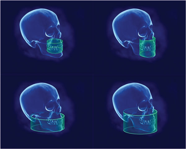iCAT – Athens Dental Depot